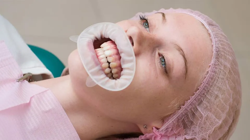 Gum Aesthetics | Periodontology - Mediwell Clinic