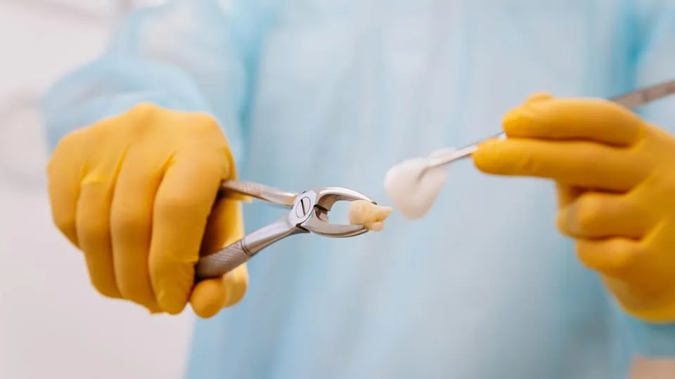 Tooth Extraction - Mediwell Clinic