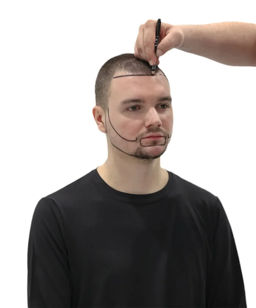 Hair Clinic - Mediwell Clinic