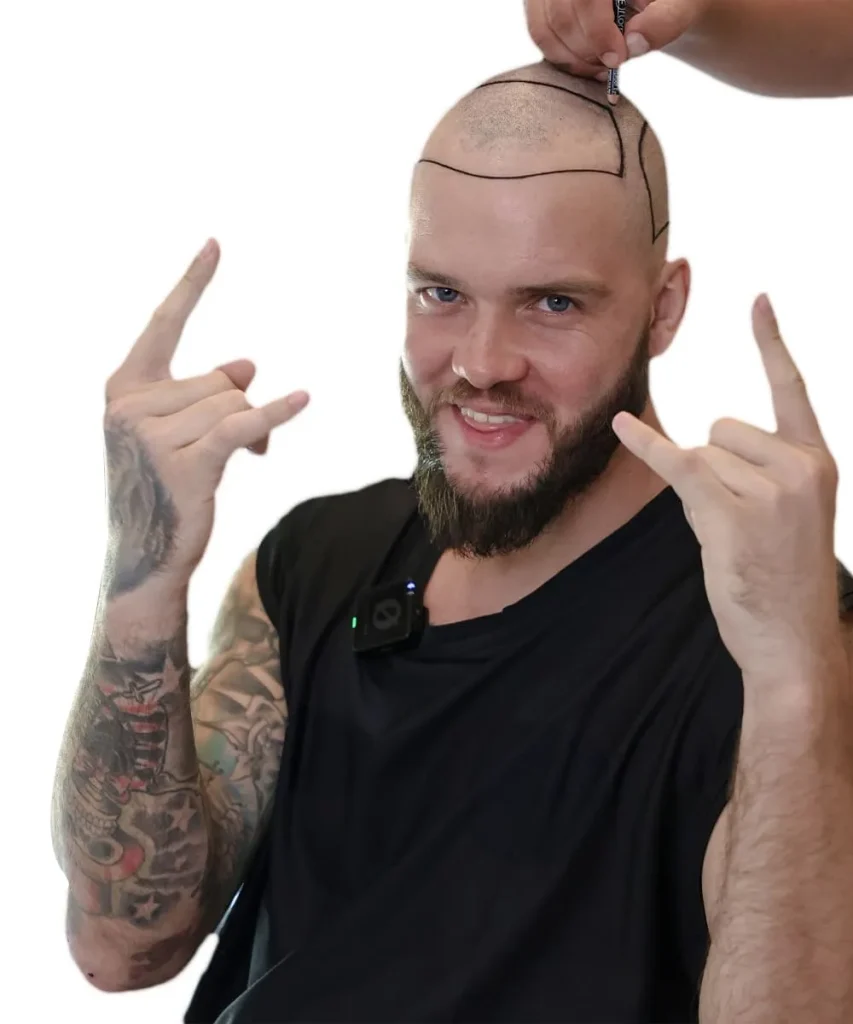 Hair Clinic - Mediwell Clinic