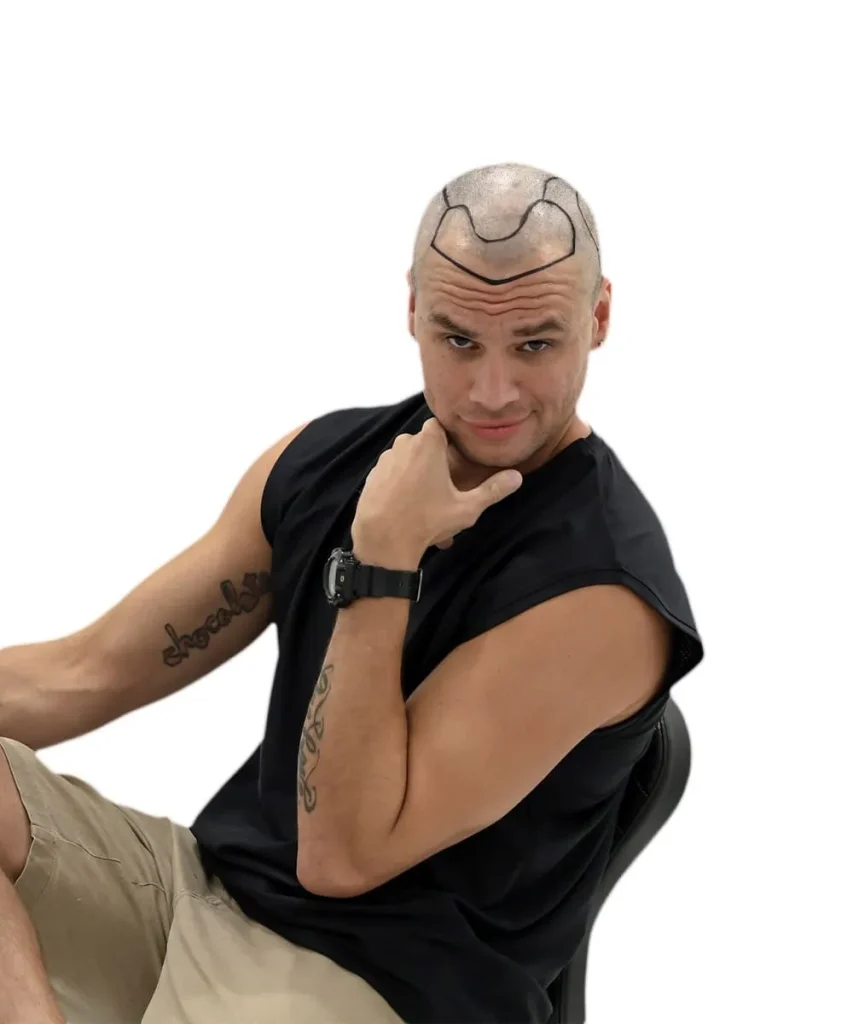 Hair Clinic - Mediwell Clinic